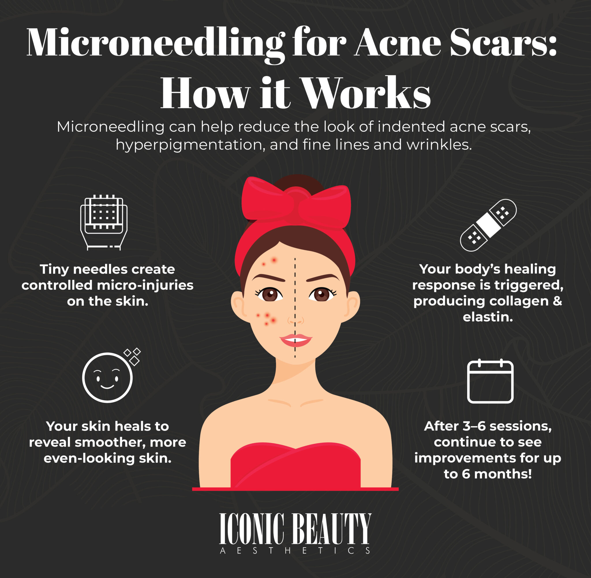 Microneedling for Acne Scars: What to Know | Red Deer