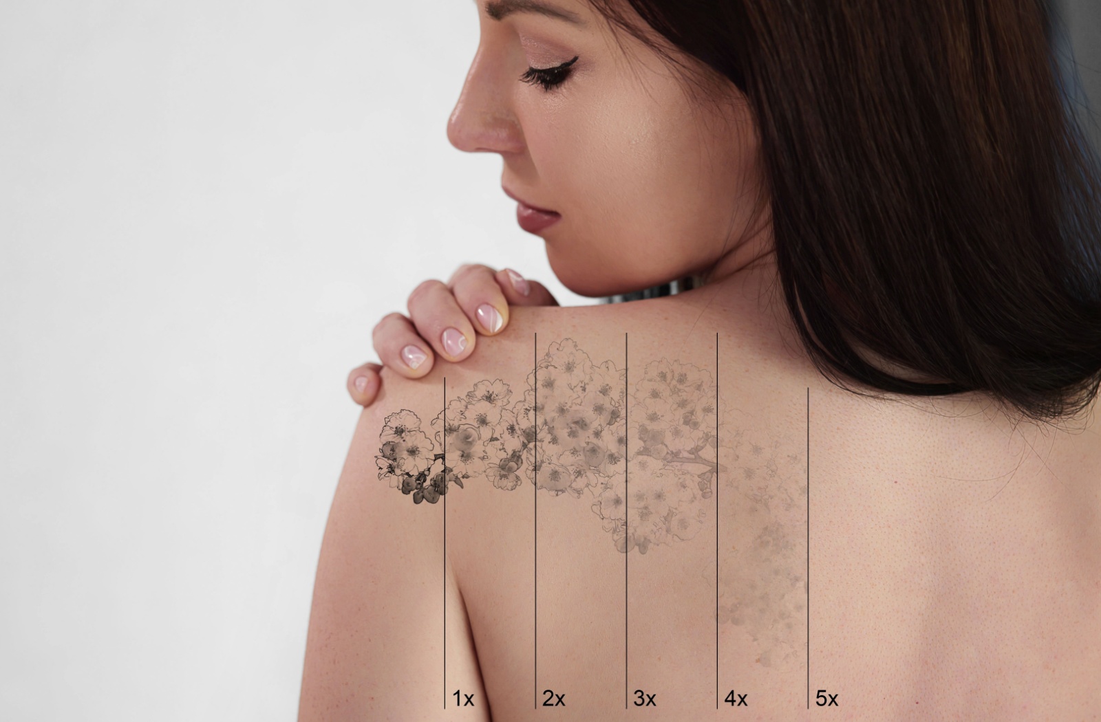 How Does Laser Tattoo Removal Work? | Red Deer, AB